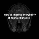 How to Improve the Quality of Your MRI Images - 3DBiology.com