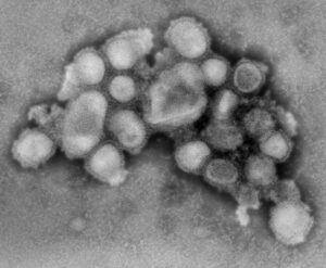 What Type of Microscope Produces 3 Dimensional Images? - 3DBiology.com