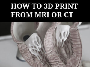 How to 3D Print from CT or MRI Scans - 3DBiology.com